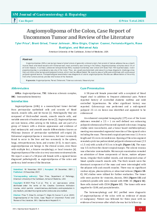 (PDF) Angiomyolipoma of the Colon, Case Report of Uncommon Tumor and ...