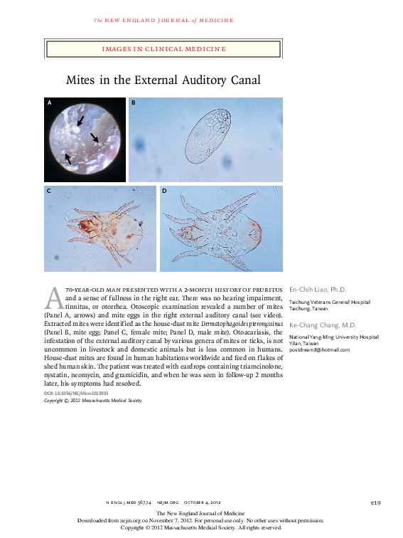 (PDF) Mites in the External Auditory Canal