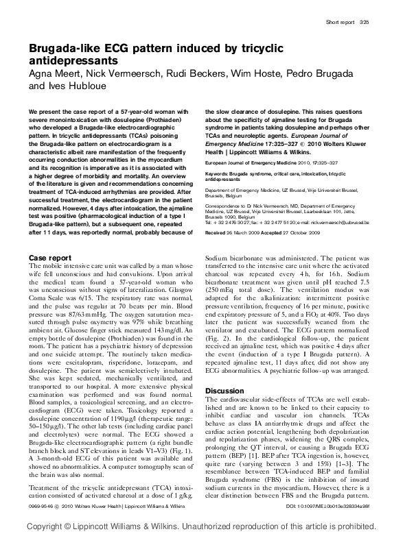 (PDF) Brugada-like ECG pattern induced by tricyclic antidepressants