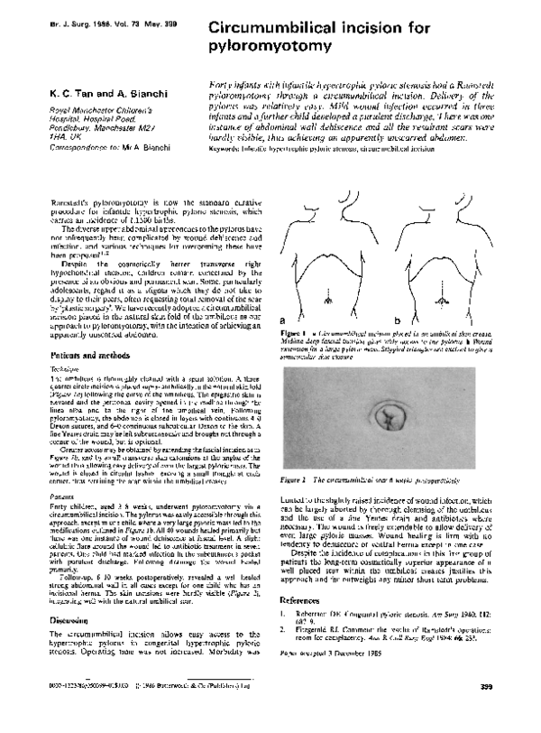 (PDF) Circumumbilical incision for pyloromyotomy