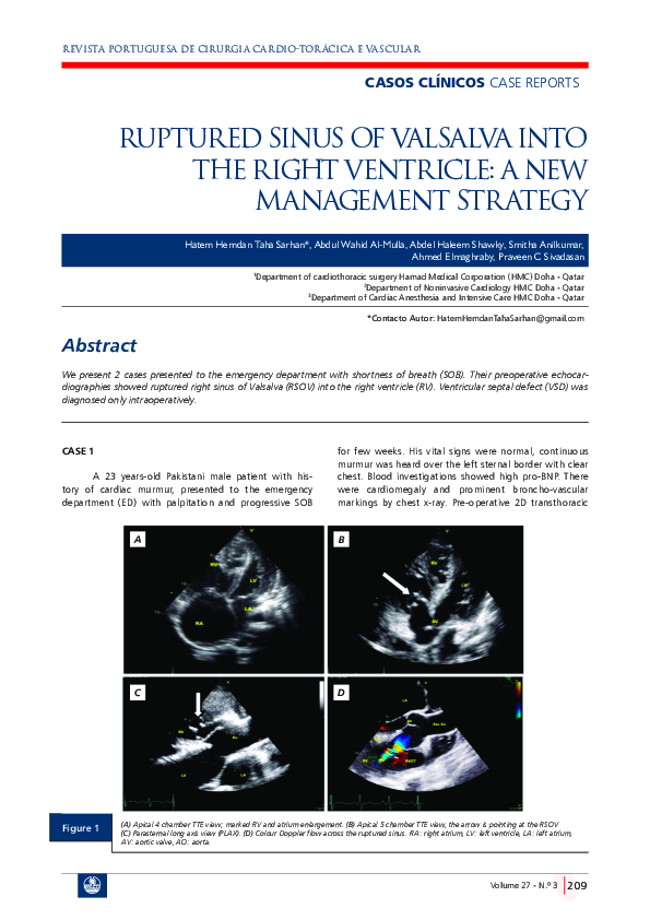 (PDF) Ruptured Sinus of Valsalva Into the Right Ventricle: A New ...