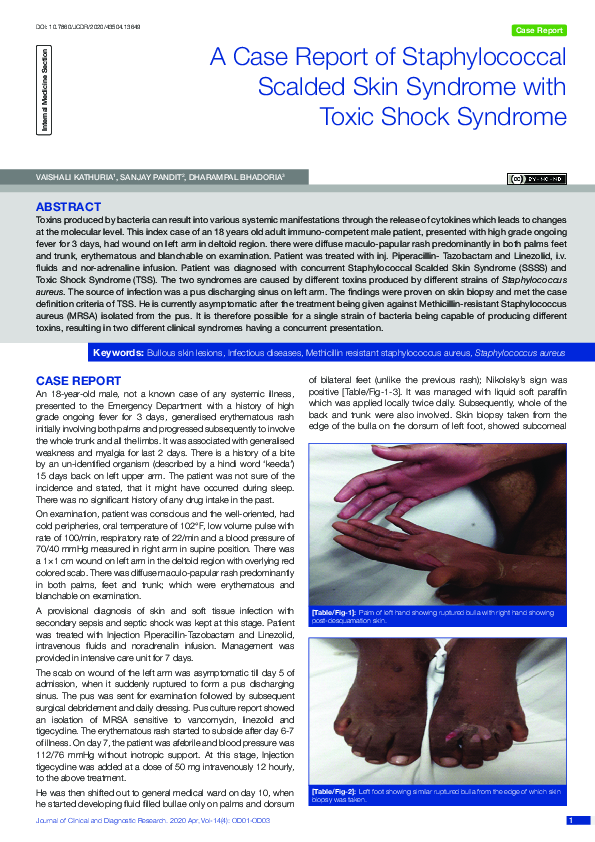(PDF) A Case Report of Staphylococcal Scalded Skin Syndrome with Toxic ...