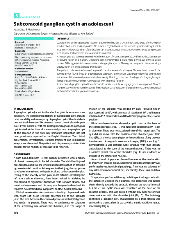 (PDF) Subcoracoid Ganglion Cyst in a Teenager