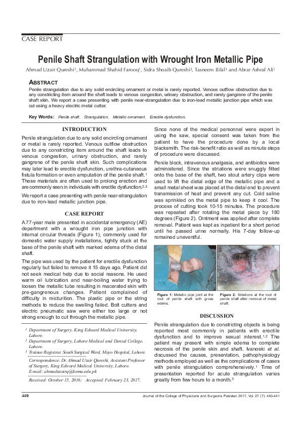 (PDF) Penile Shaft Strangulation with Wrought Iron Metallic Pipe | Ahmad Uzair Qureshi ...