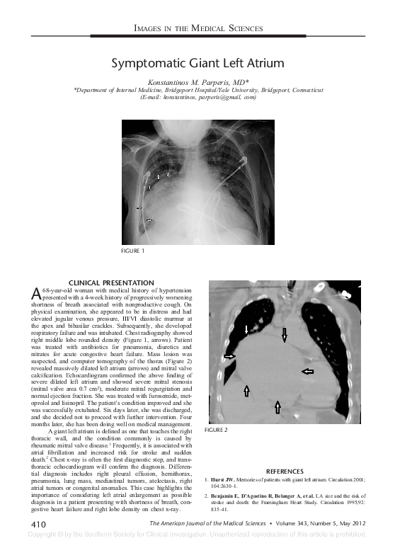 (PDF) Symptomatic Giant Left Atrium