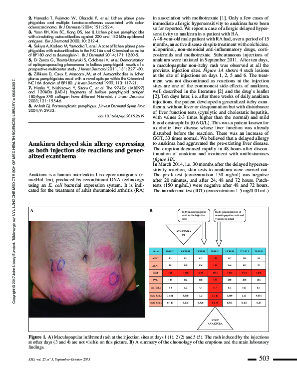 (PDF) Anakinra delayed skin allergy expressing as both injection site ...