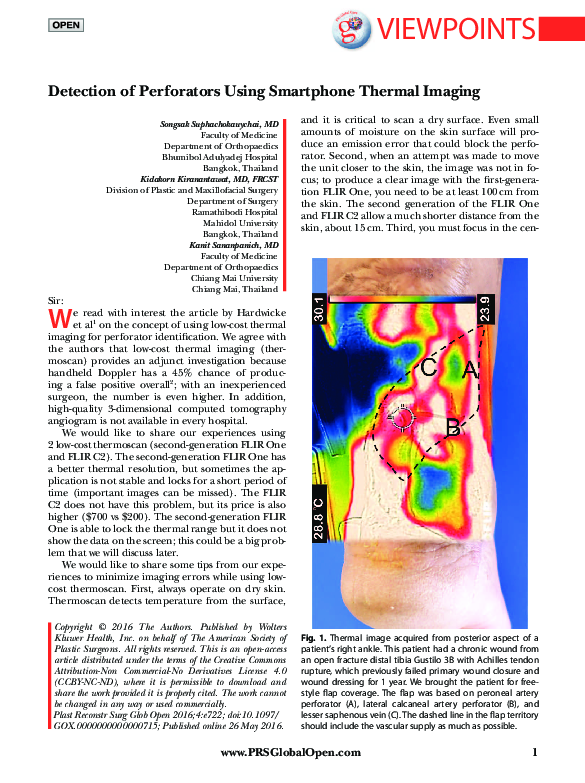 (PDF) Detection of Perforators Using Smartphone Thermal Imaging | Kanit Sananpanich - Academia.edu