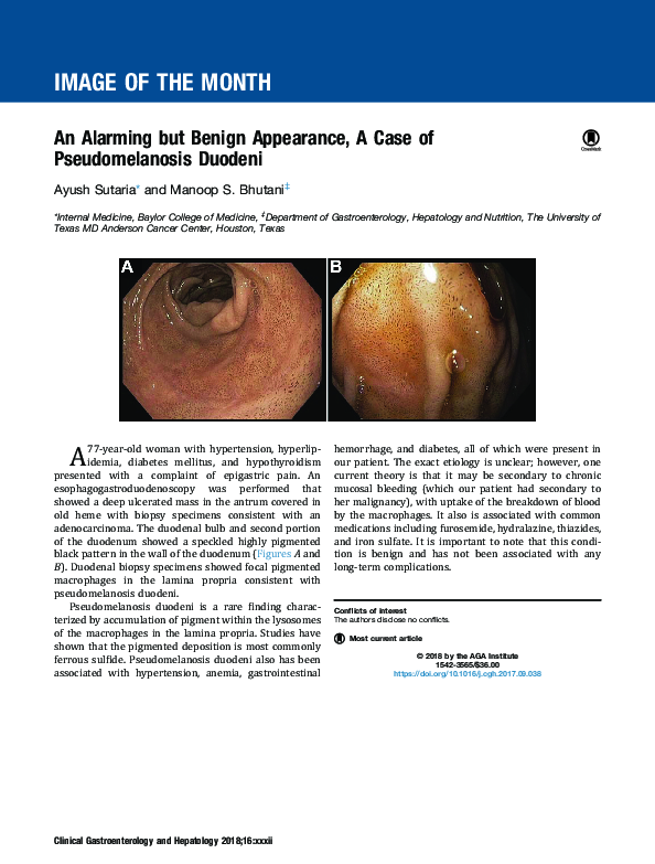 (PDF) An Alarming but Benign Appearance, A Case of Pseudomelanosis Duodeni