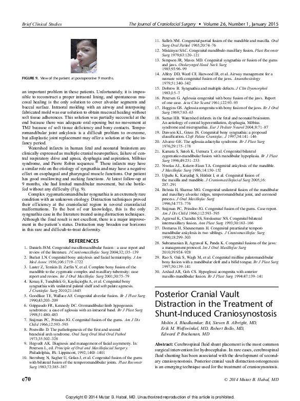 (PDF) Posterior Cranial Vault Distraction in the Treatment of Shunt ...