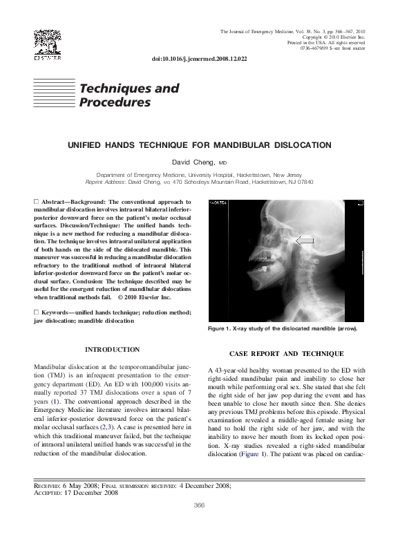 (PDF) Unified Hands Technique for Mandibular Dislocation