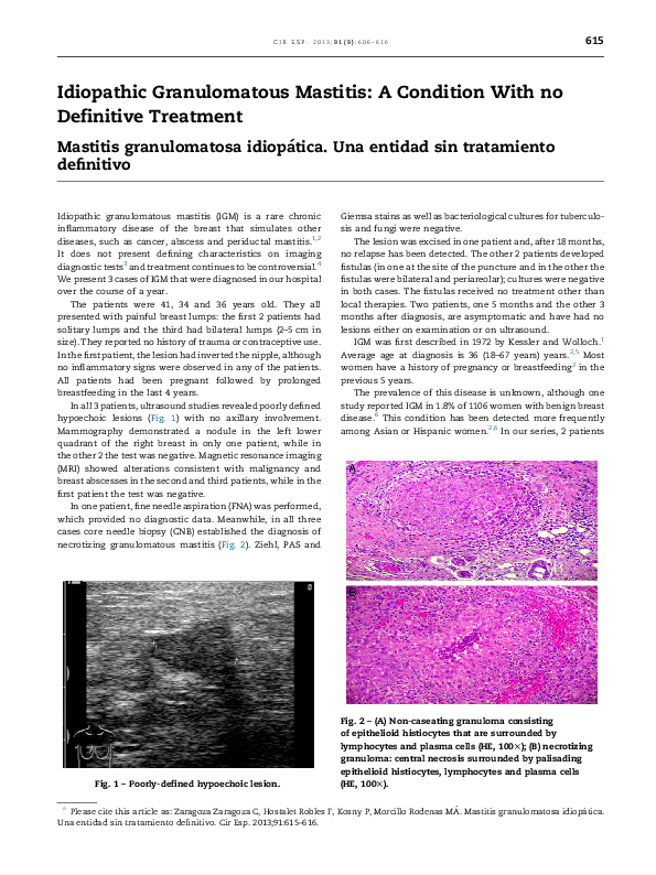 (PDF) Idiopathic Granulomatous Mastitis: A Condition With no Definitive Treatment