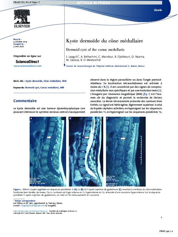 (PDF) Kyste dermoïde du cône médullaire