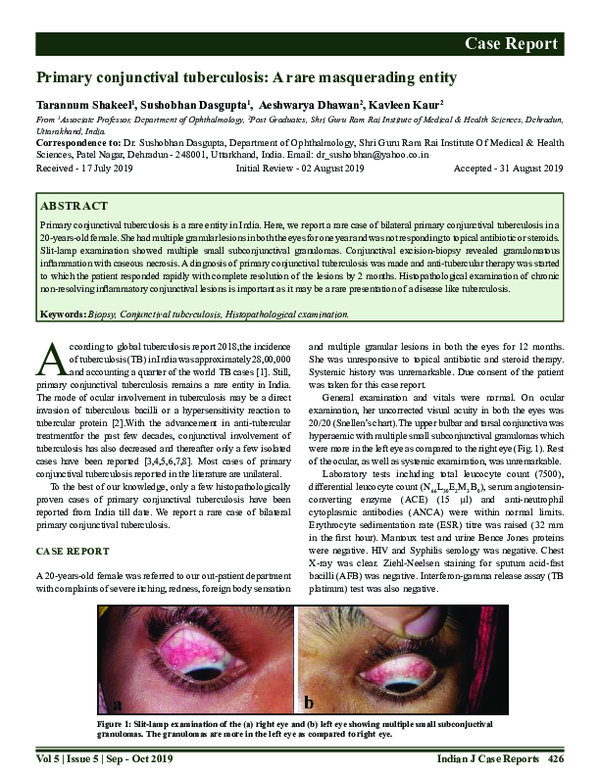 (PDF) Primary Conjunctival Tuberculosis: A Rare Masquerading Entity