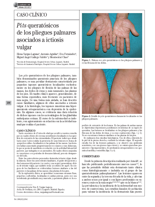 (PDF) Pits queratósicos de los pliegues palmares asociados a ictiosis ...