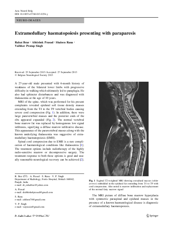 (PDF) Extramedullary haematopoiesis presenting with paraparesis