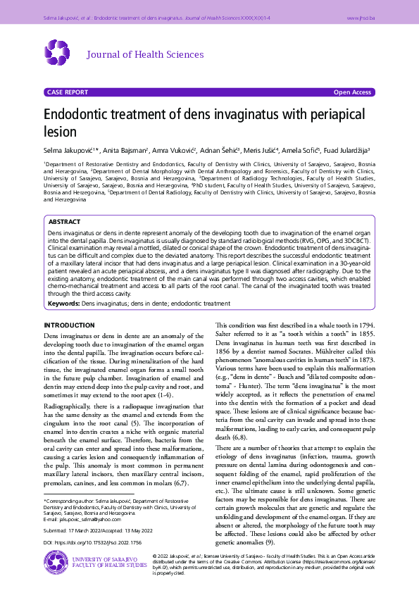 (PDF) Endodontic treatment of dens invaginatus with periapical lesion