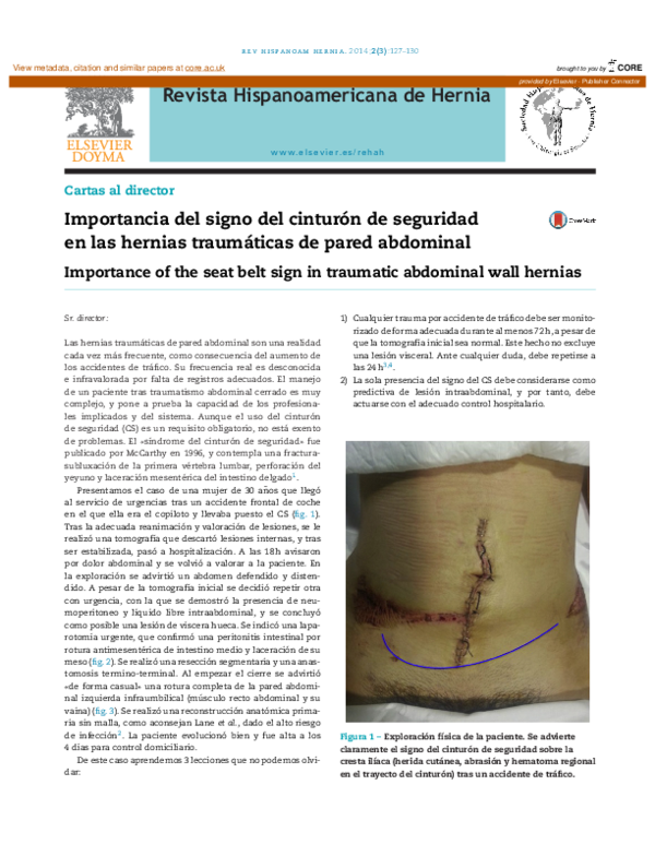 (PDF) Importancia del signo del cinturón de seguridad en las hernias ...