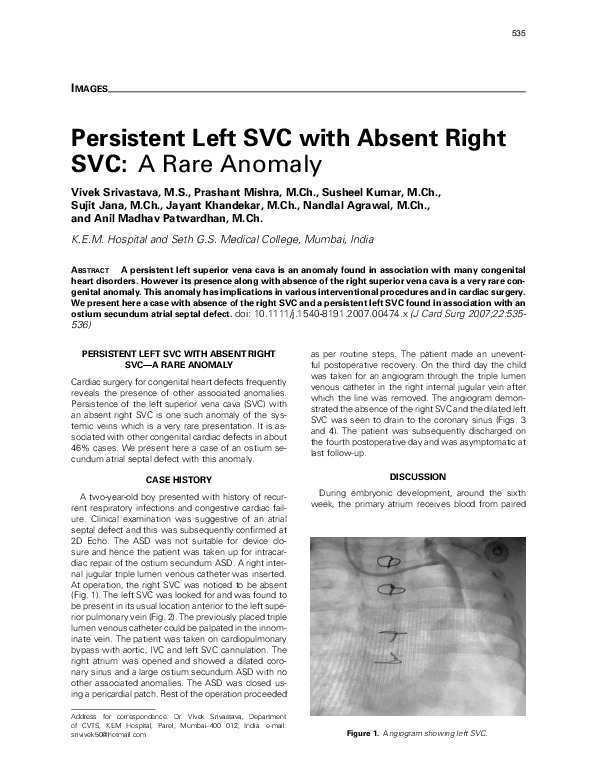 (PDF) Persistent Left SVC with Absent Right SVC: A Rare Anomaly