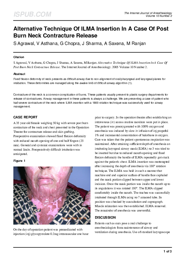 (PDF) Alternative Technique Of ILMA Insertion In A Case Of Post Burn ...