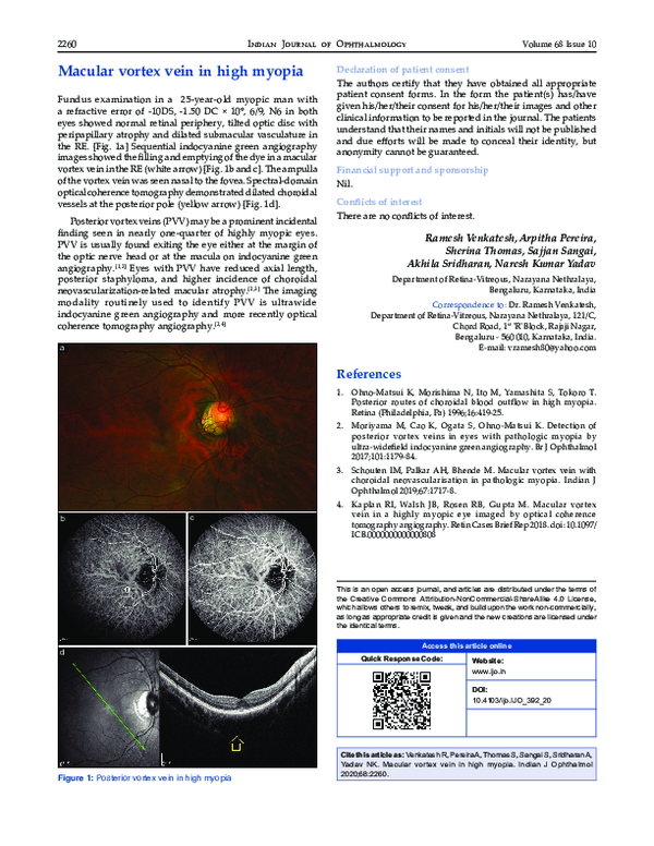 (PDF) Macular vortex vein in high myopia | Dr.Akhila sridharan ...