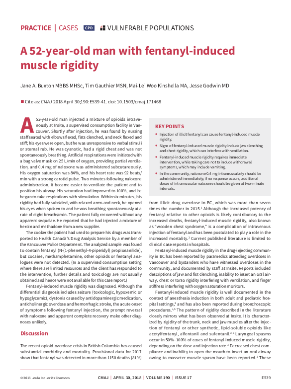 (PDF) A 52-year-old man with fentanyl-induced muscle rigidity