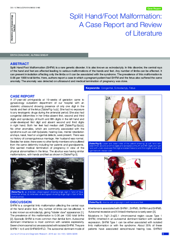 (PDF) Split Hand/Foot Malformation: A Case Report and Review of ...