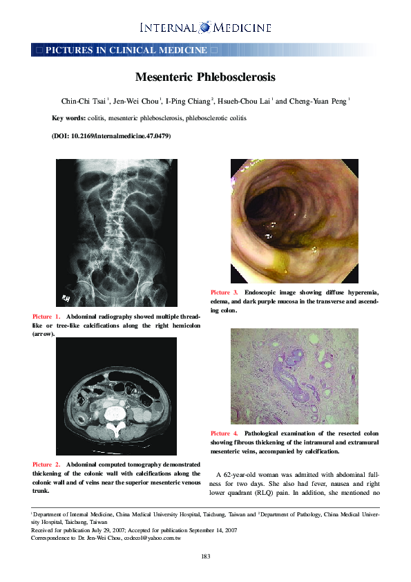 (PDF) Mesenteric Phlebosclerosis