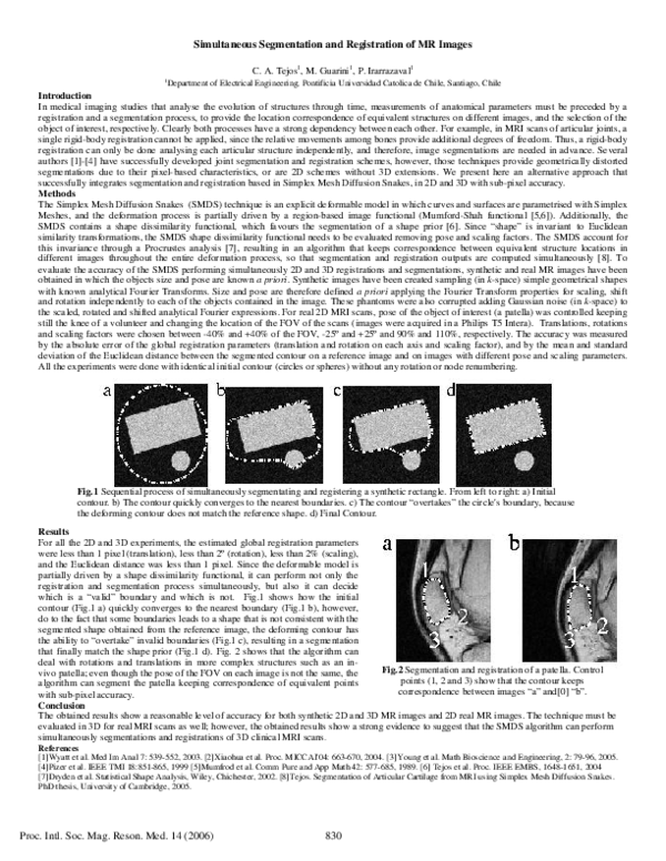 Pdf Simultaneous Segmentation And Registration Of Mr Images