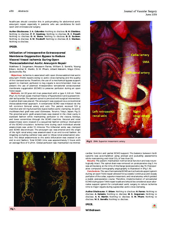 (PDF) IP029. Utilization of Intraoperative Extracorporeal Membrane ...
