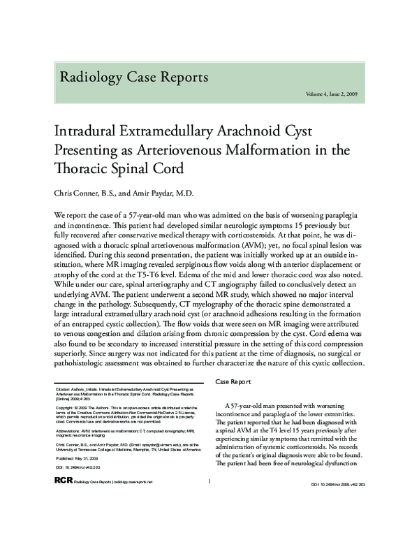 (PDF) Intradural Extramedullary Arachnoid Cyst Presenting as ...