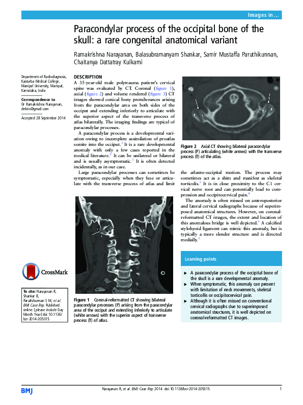 (PDF) Paracondylar process of the occipital bone of the skull: a rare ...