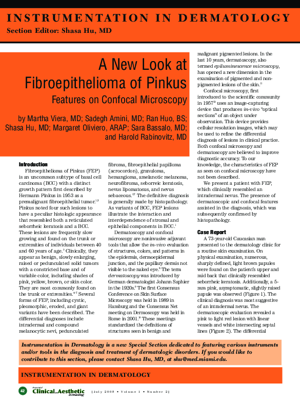 (PDF) A new look at fibroepithelioma of pinkus: features on confocal ...