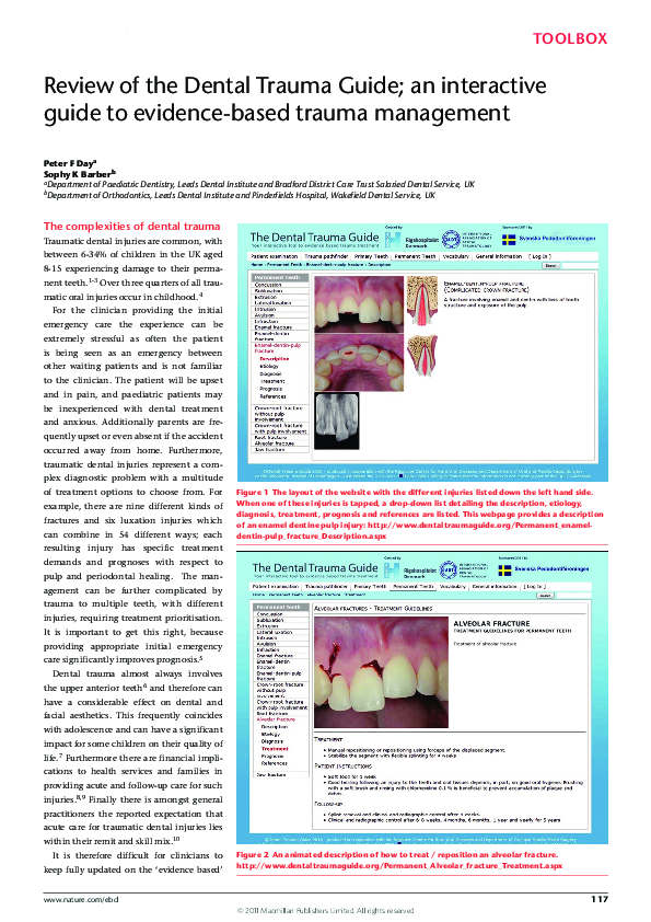 (PDF) Review of the dental trauma guide; an interactive guide to ...