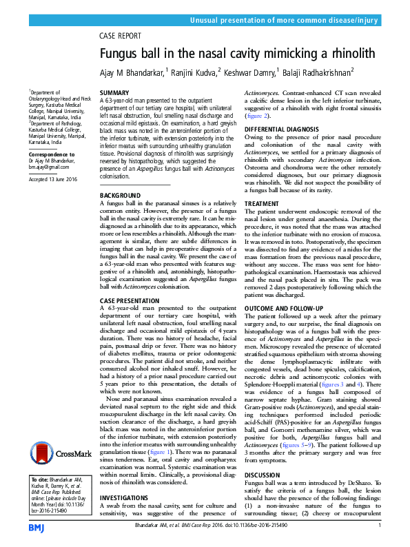 (PDF) Fungus ball in the nasal cavity mimicking a rhinolith