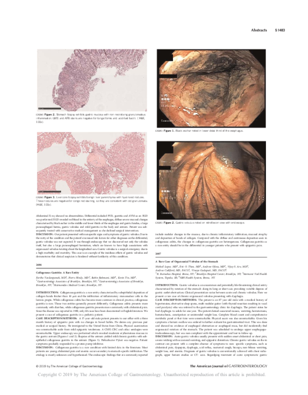 (PDF) A Rare Case of Organoaxial Volvulus of the Stomach