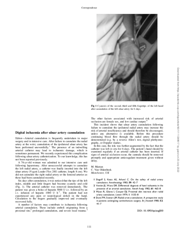 (PDF) Digital ischaemia after ulnar artery cannulation