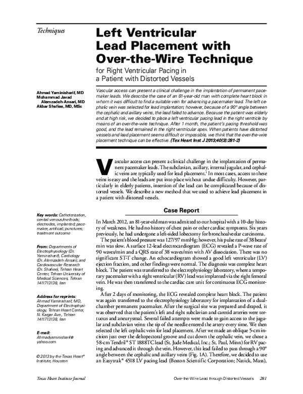 (PDF) Left ventricular lead placement with over-the-wire technique for ...