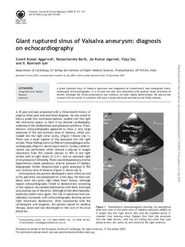 (PDF) Giant ruptured sinus of Valsalva aneurysm: Diagnosis on ...