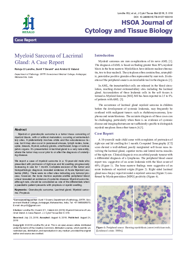 (PDF) Myeloid Sarcoma of Lacrimal Gland: A Case Report | Dr Sunil Y ...