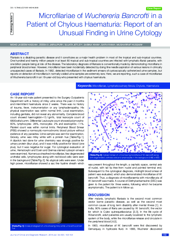(PDF) Microfilariae of wuchereria bancrofti in a patient of chylous ...