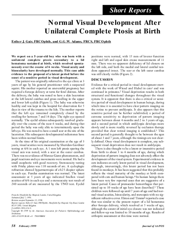 (PDF) Normal visual development after unilateral complete ptosis at birth