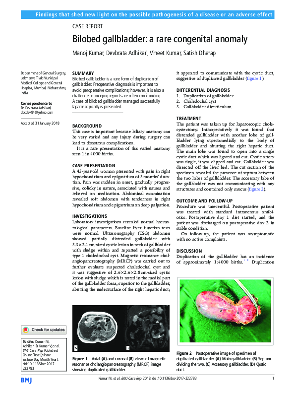 (PDF) Bilobed gallbladder: a rare congenital anomaly | Satish Dharap ...