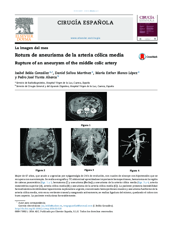(PDF) Rotura de aneurisma de la arteria cólica media
