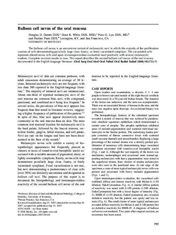 (PDF) Balloon cell nevus of the oral mucosa | pauline puno - Academia.edu