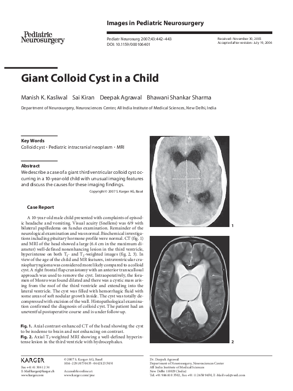 (PDF) Giant Colloid Cyst in a Child