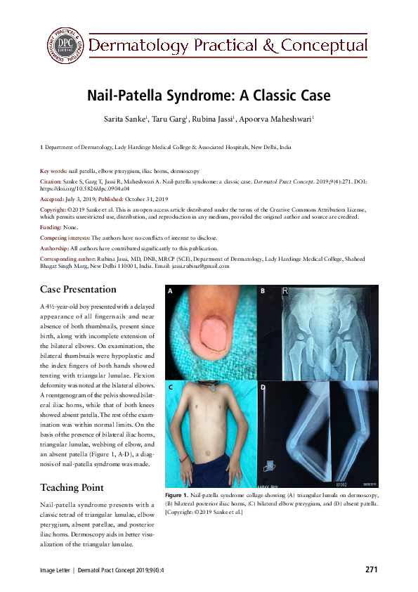 (PDF) Nail-Patella Syndrome: A Classic Case