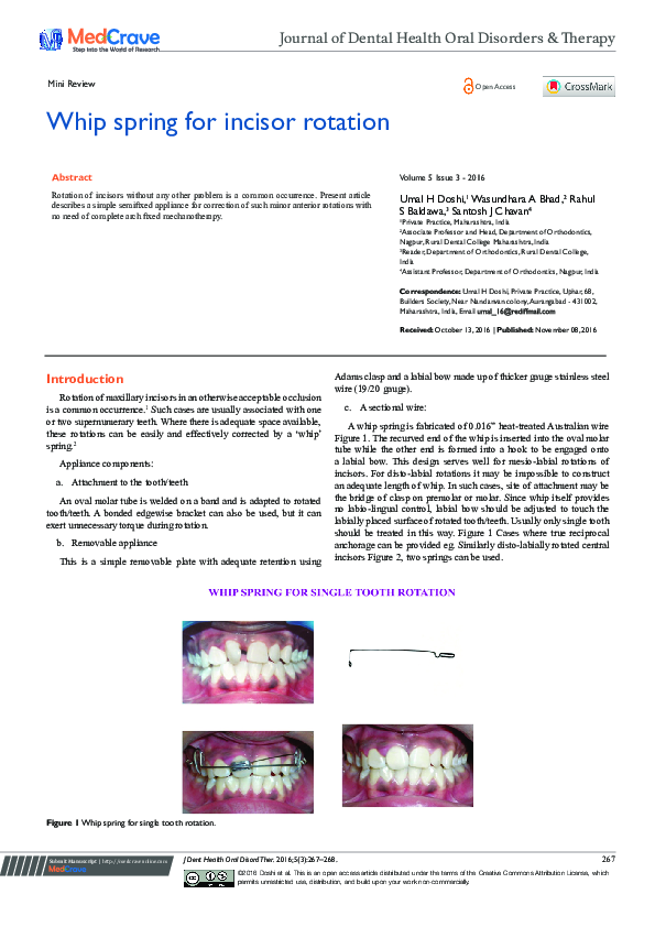 (PDF) Whip Spring for Incisor Rotation