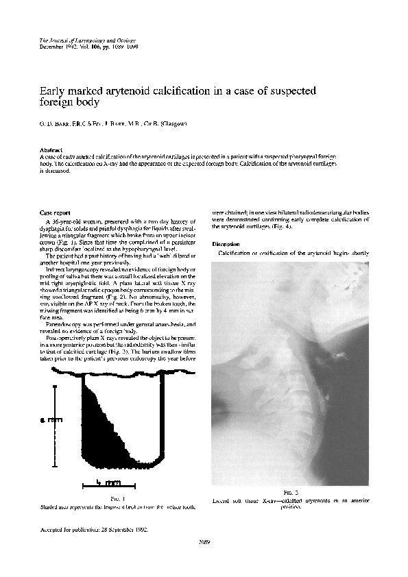 (PDF) Early marked arytenoid calcification in a case of suspected ...