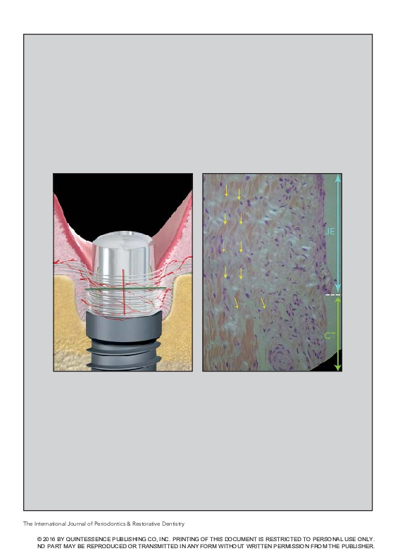 (PDF) Arrangement of Peri-implant Connective Tissue Fibers Around ...