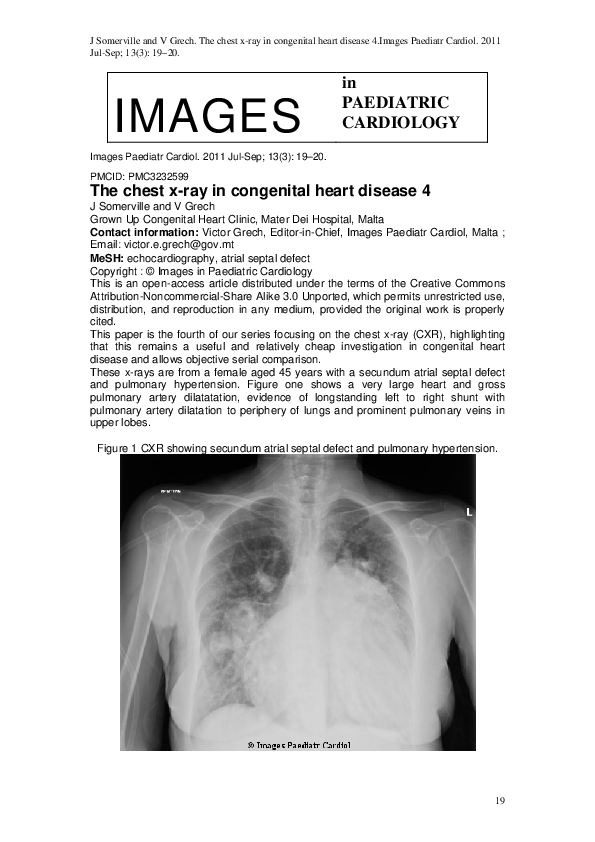(PDF) The chest x-ray in congenital heart disease 4.Images Paediatr Cardiol | Victor Grech ...